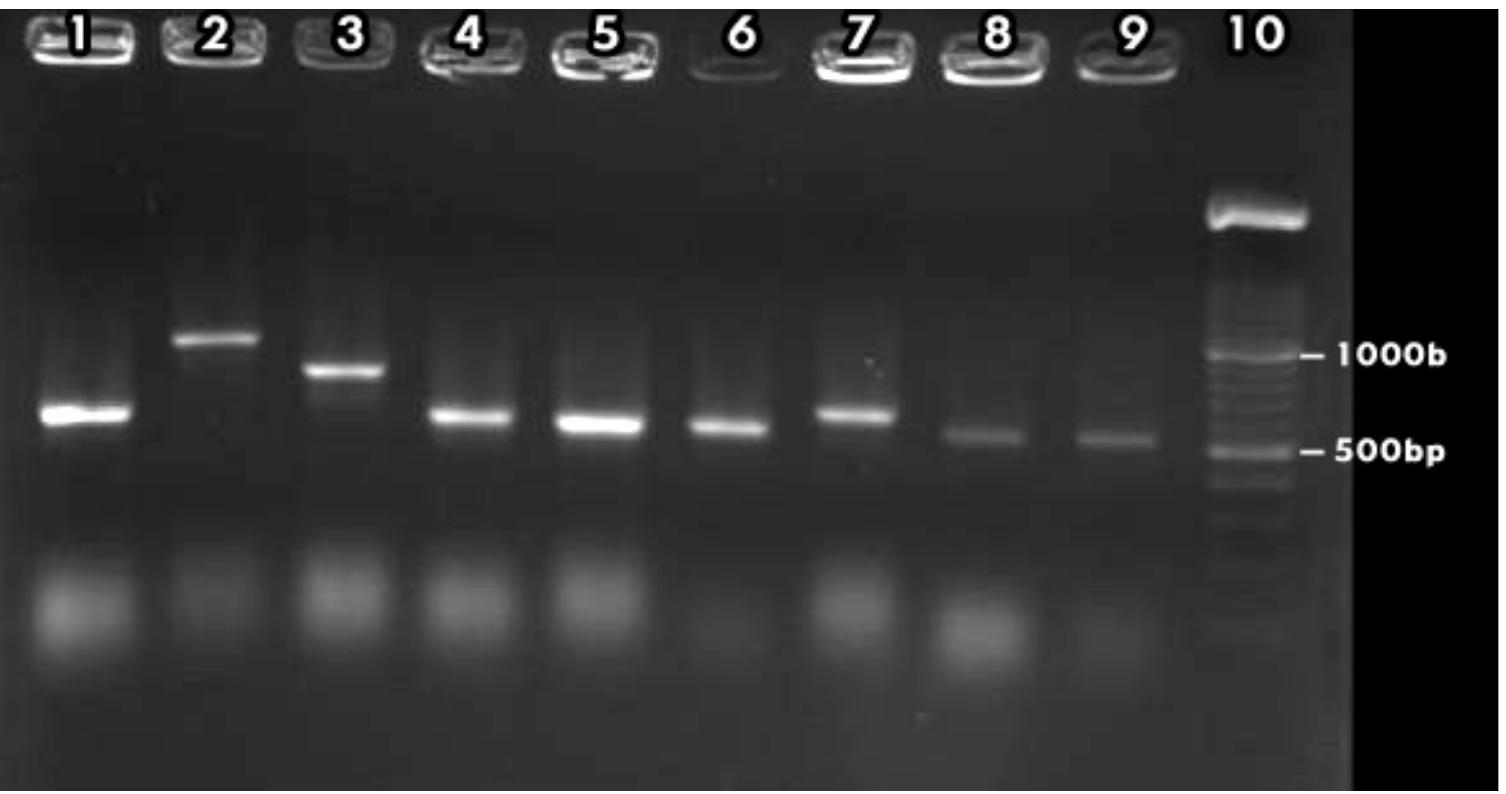 Agarose gel electrophoresis of direct colony-pcr using the