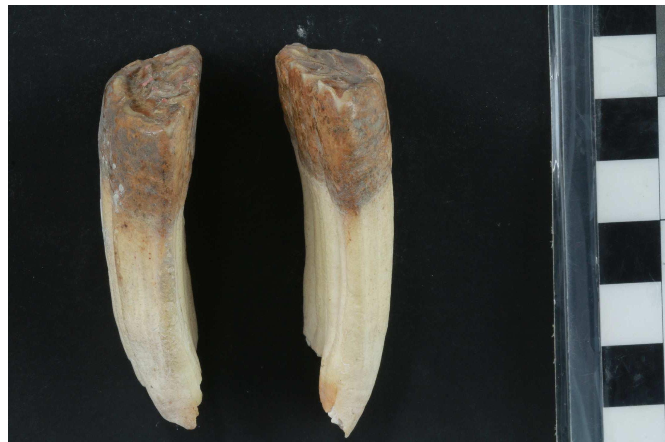 Photograph of mesial/anterior face of both left and right