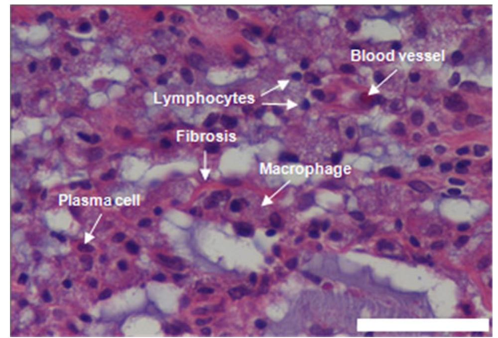 Histological image of skin and subcutaneous tissues from the