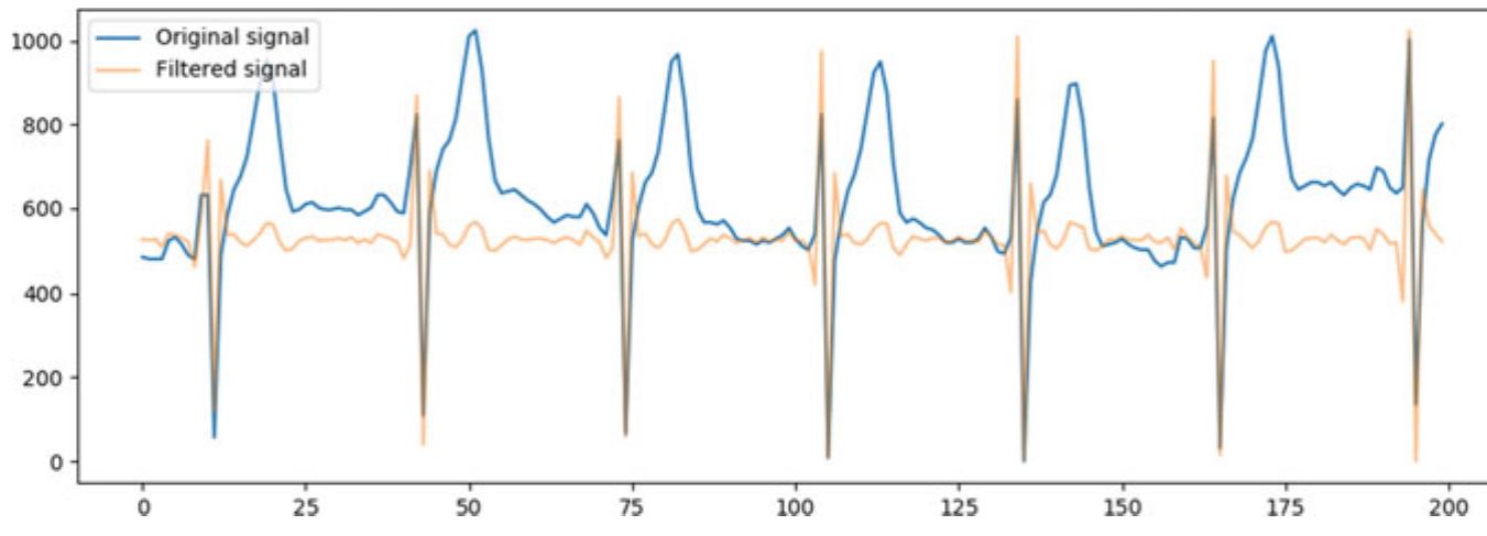 Comparison of the raw and filtered ecg signal