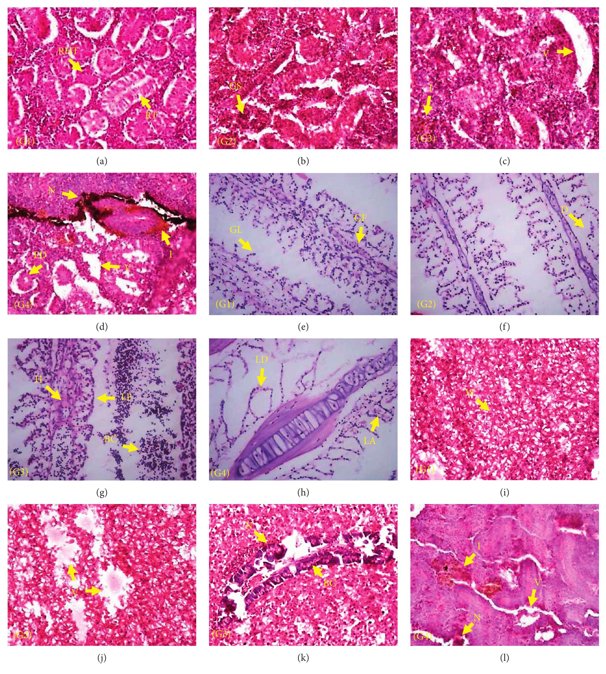(a-d) histology of kidney. g1 showed normal structure of