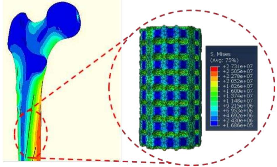 Simulation of femur body with abaqus software with the