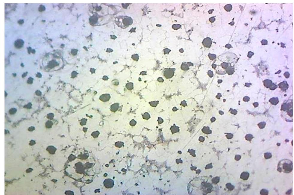 Microstructure at a magnification of 200x revealing the