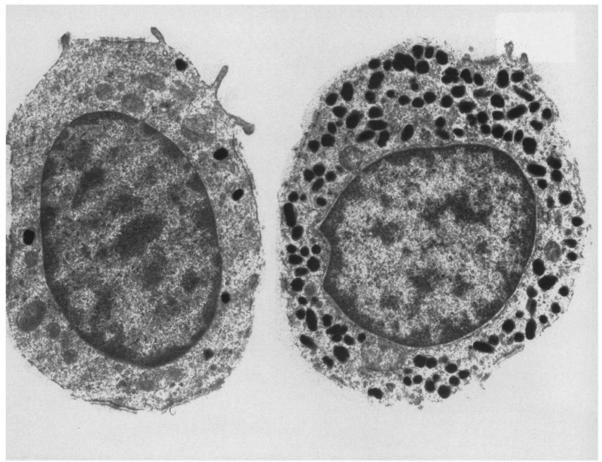 Electron microscopic photograph at 4000 of a superficial