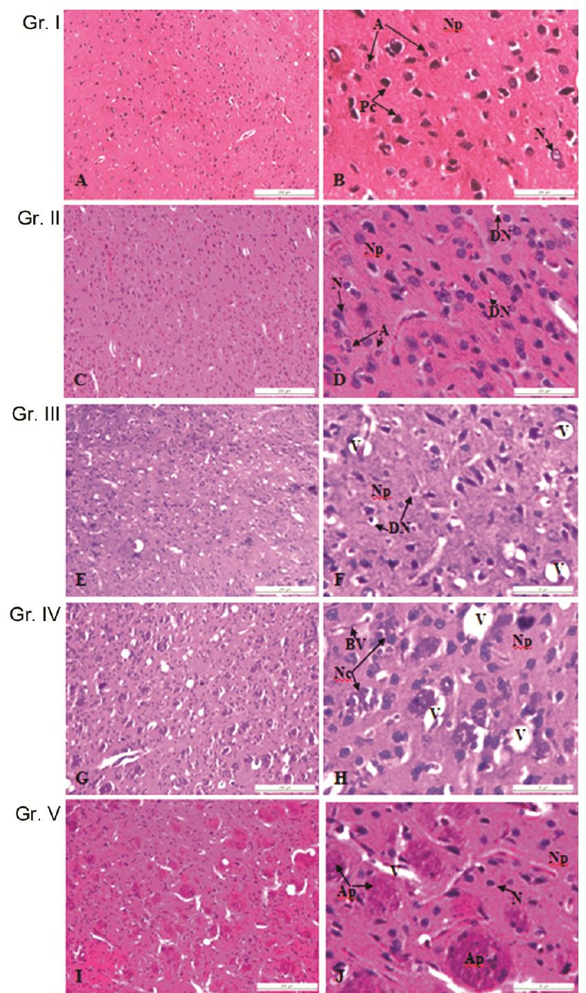 S 1 — photomicrograph of cerebral cortex region of brain of