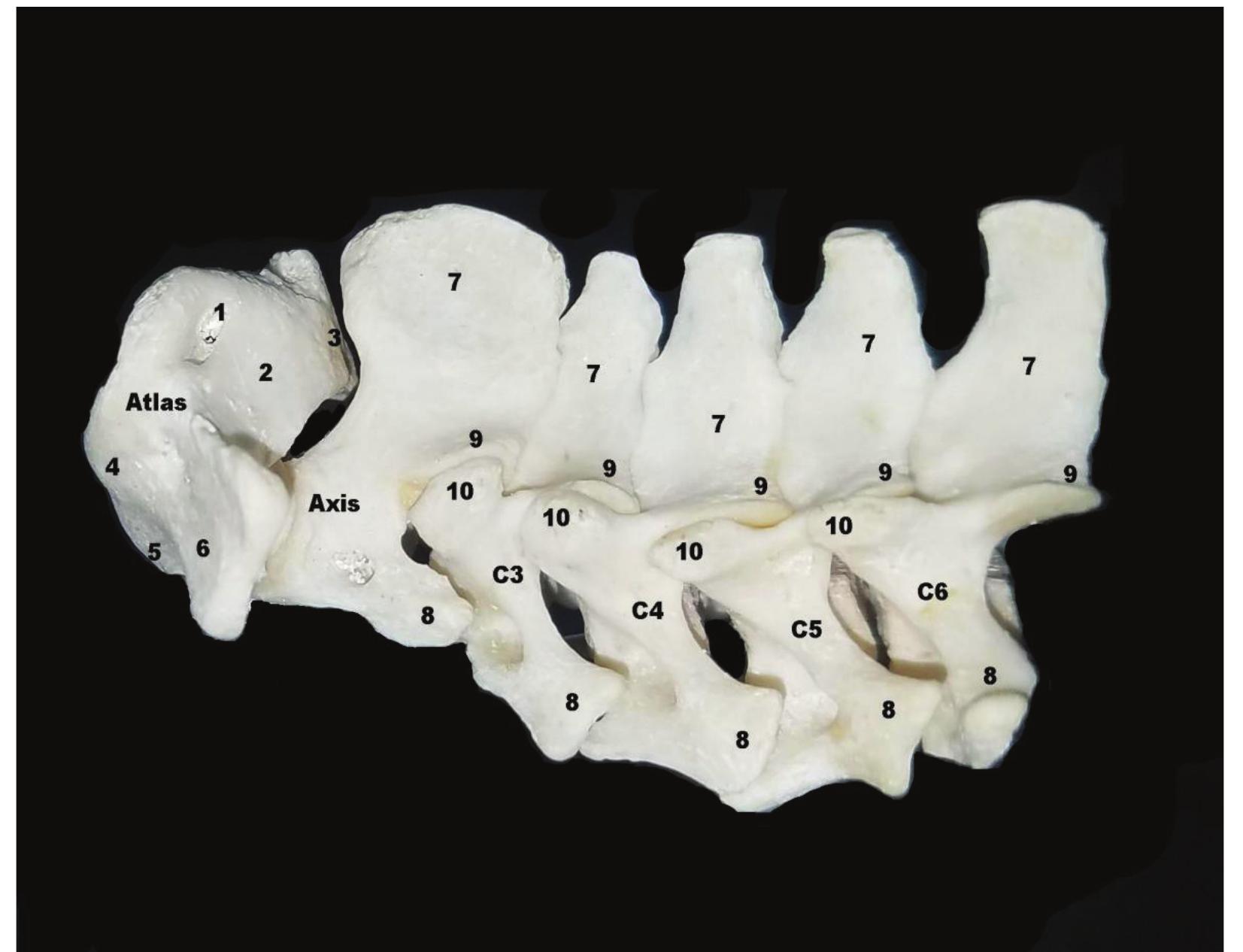 Lateral view of the cervical region of the spine, where the