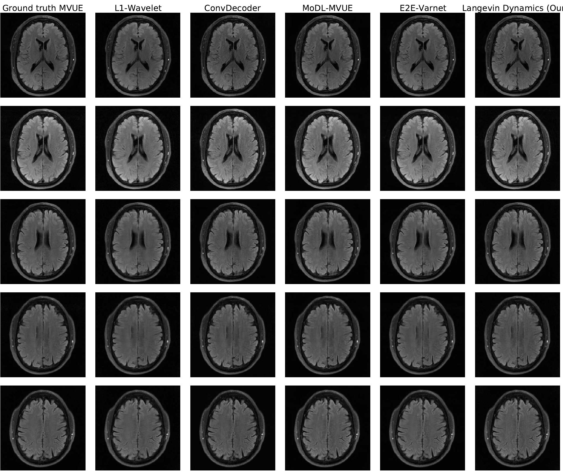 Brain reconstructions under a contrast shift, at an