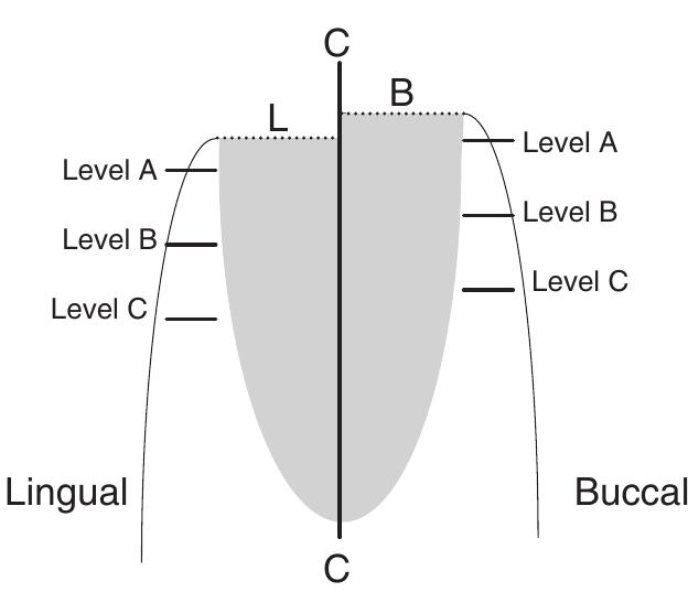 Schematic drawing representing the location where the