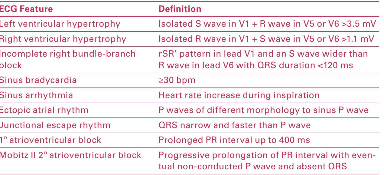 Normal ecg findings in athletes (adapted from sharma et al.,