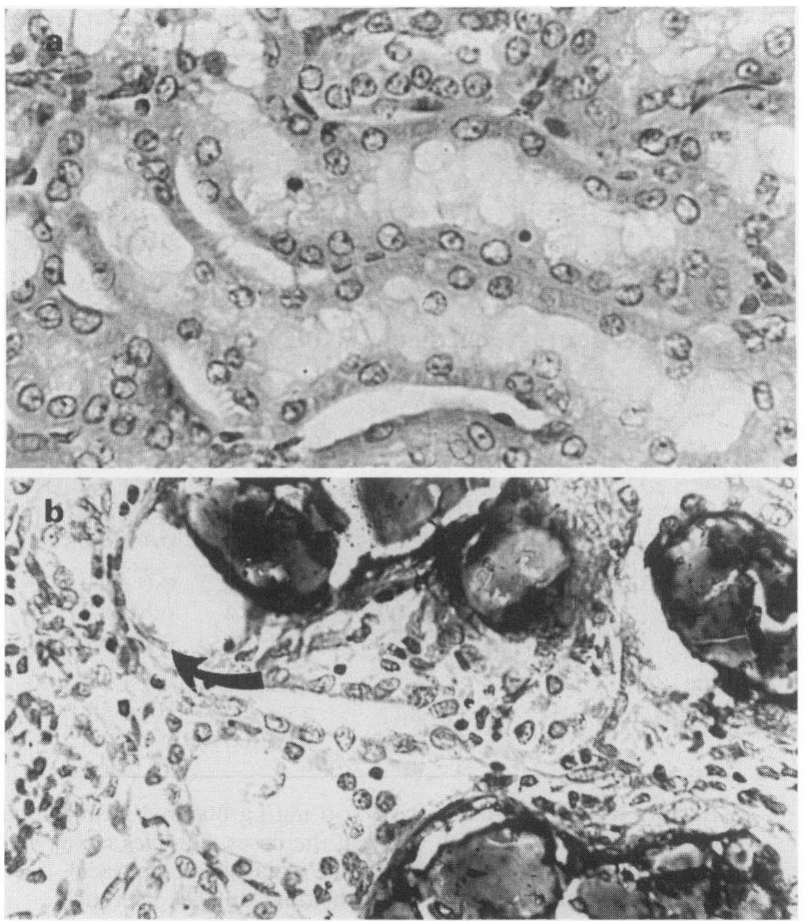 A,distal tubules from a kidney of a control rabbit; b,