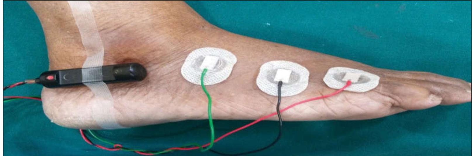 Figure 1 - from Analysis of Electrophysiological Parameters