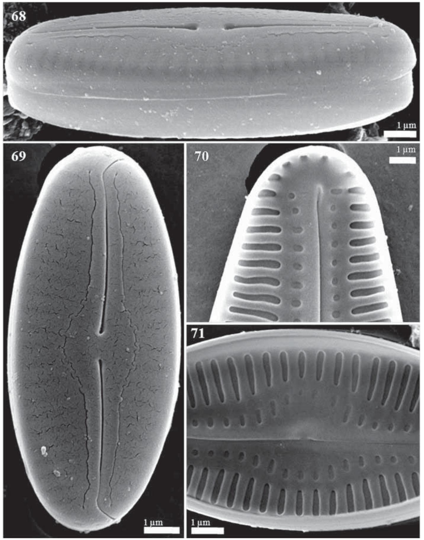 S 68-71. images from scanning electron microscopy of