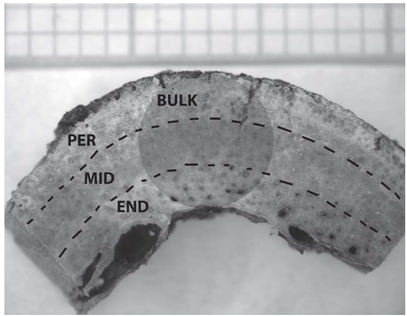 Illus 14 microscopic image of the bone sample, showing zones