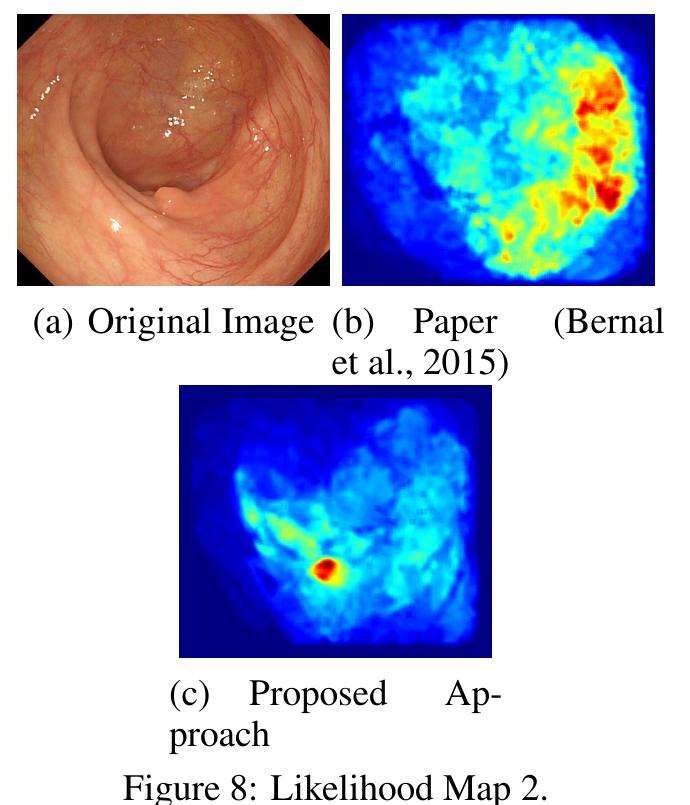 Automatic Polyp Detection From Endoscope Image Using