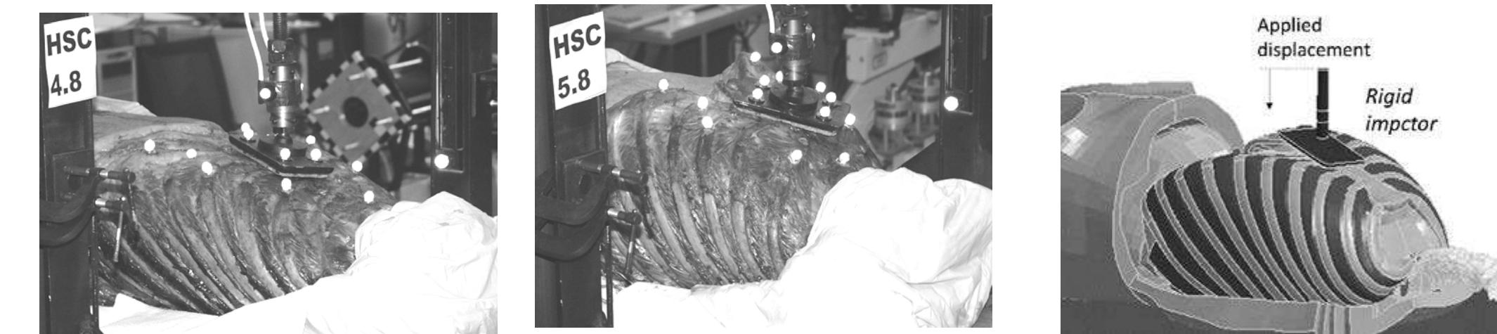 Denuded thorax indentor impacts at mid sternum (centre
