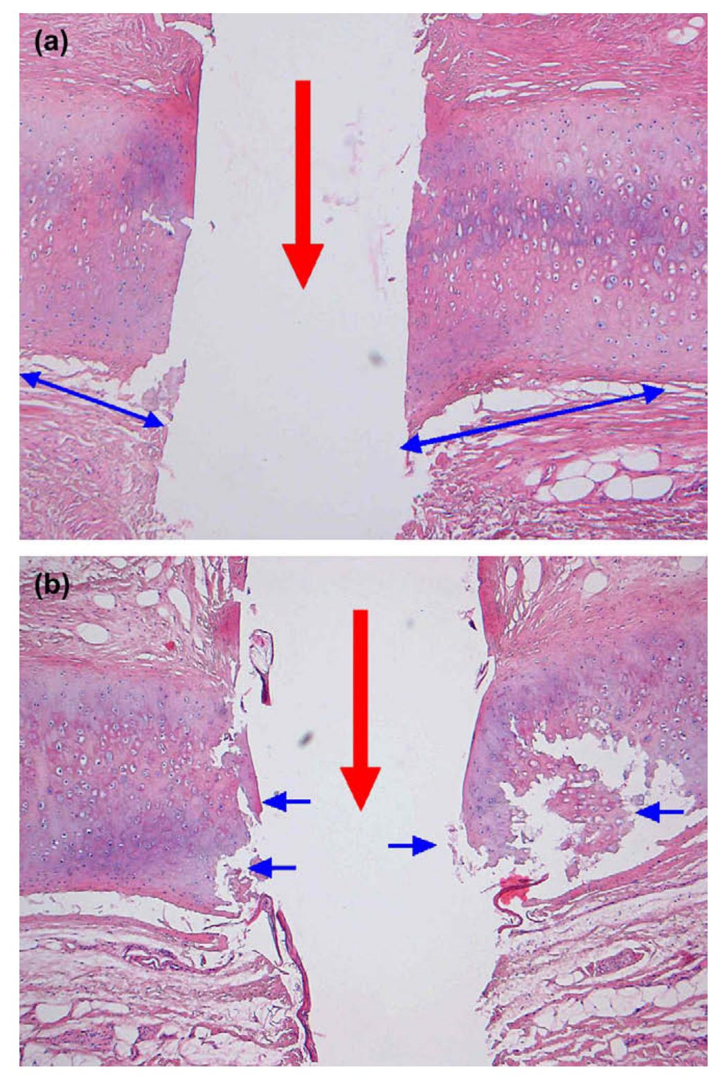 (a, b) example of injury patterns within (a): mainly