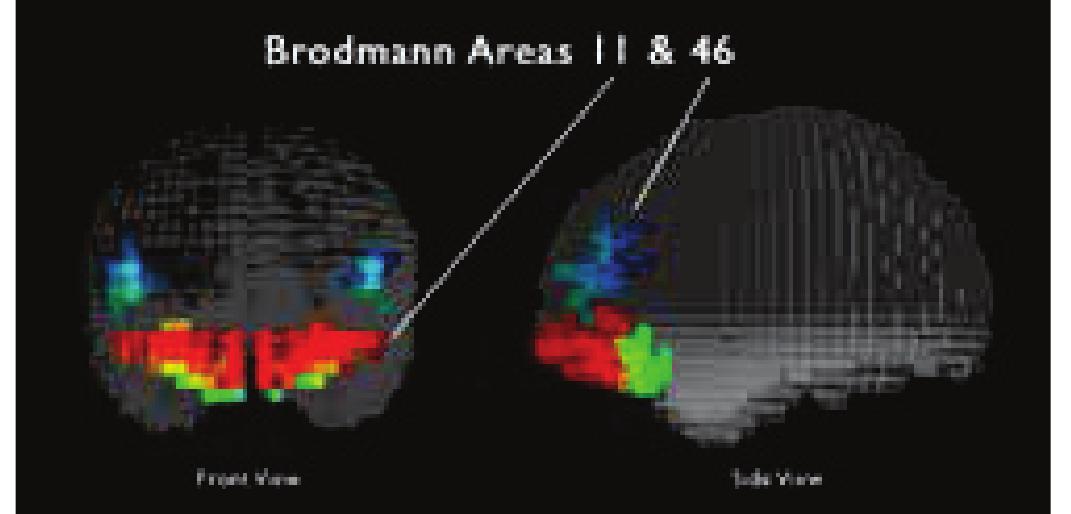 These displays are created by the eeg-based imaging system