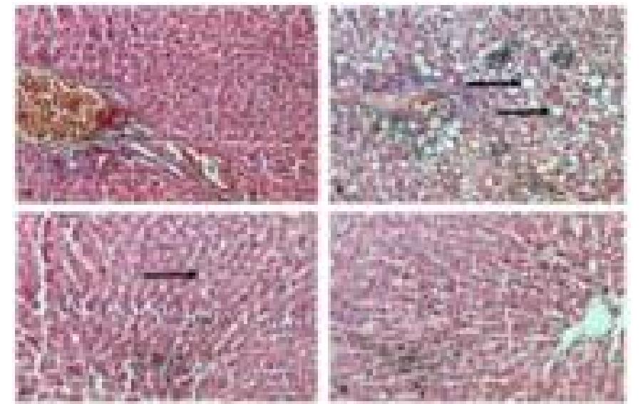 Photomicrographs of the liver revealed that the hfd control