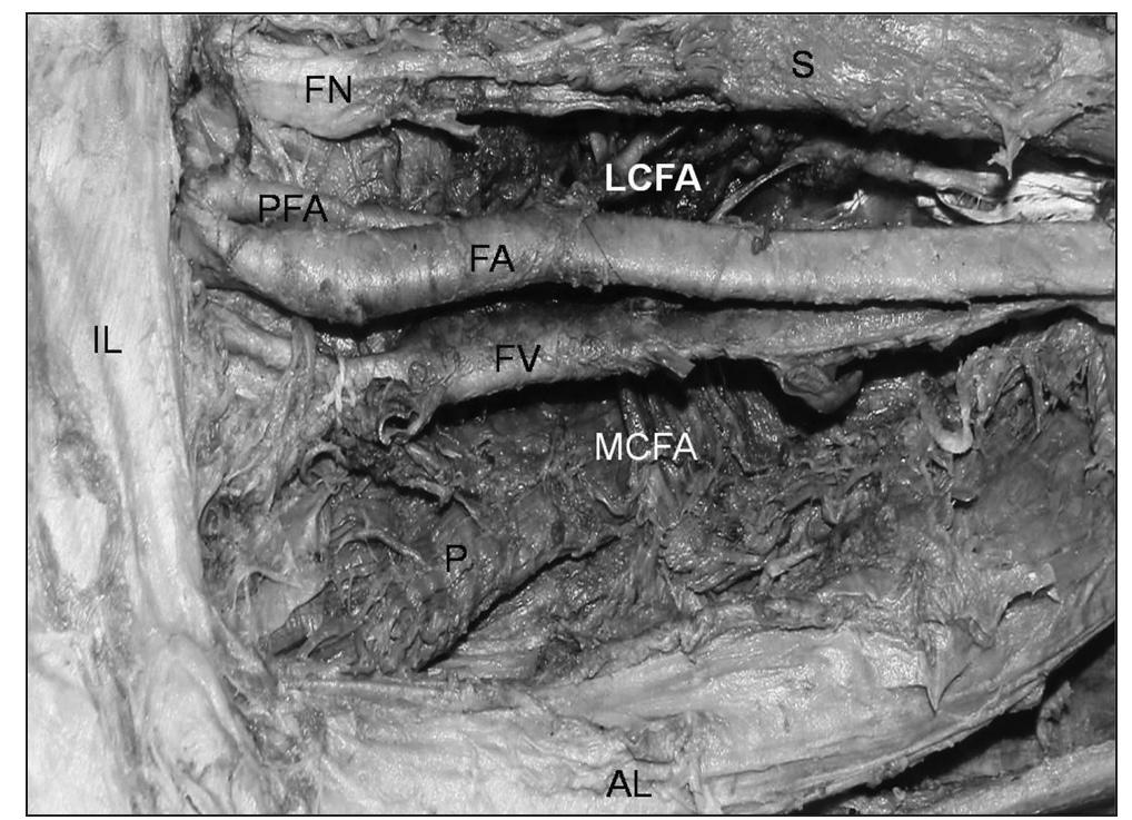 Fa- femoral artery; dfa— deep femoral artery; fv— femoral