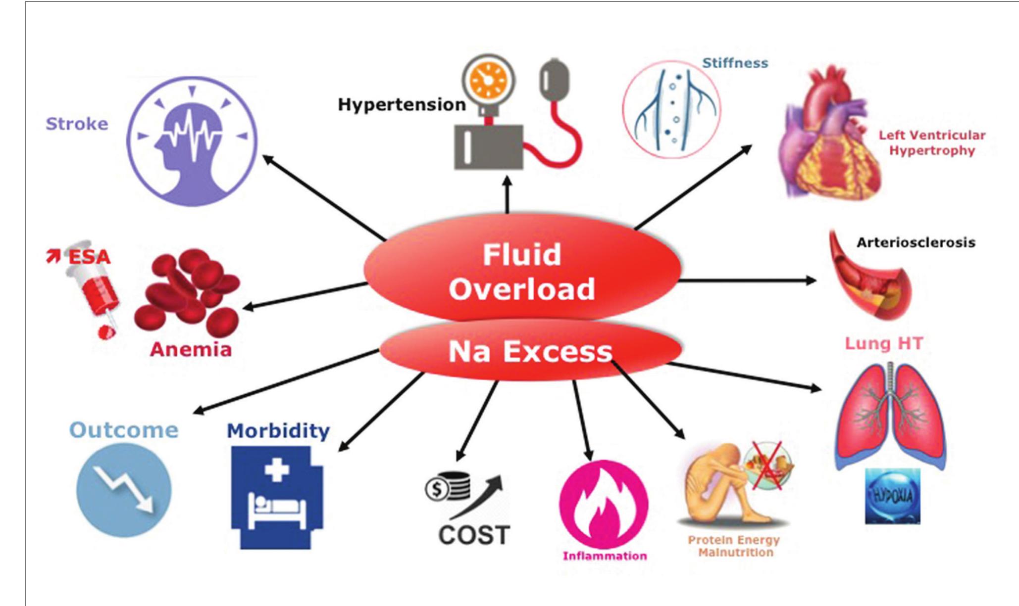 Chronic hemodynamic stress: chronic fluid overload and its