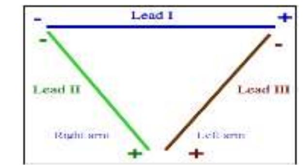 (PDF) Isolated Ecg Amplifier with Right Leg Drive