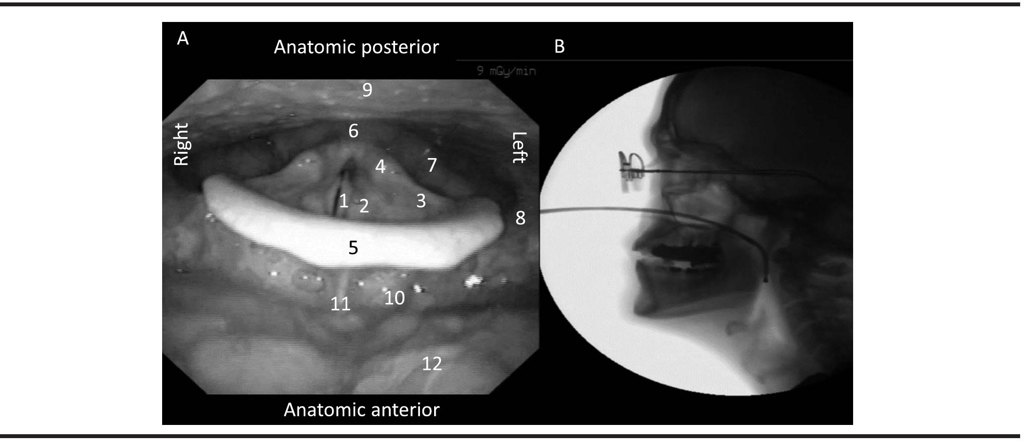(a) the flexible endoscopic image seen in figure 1a is an