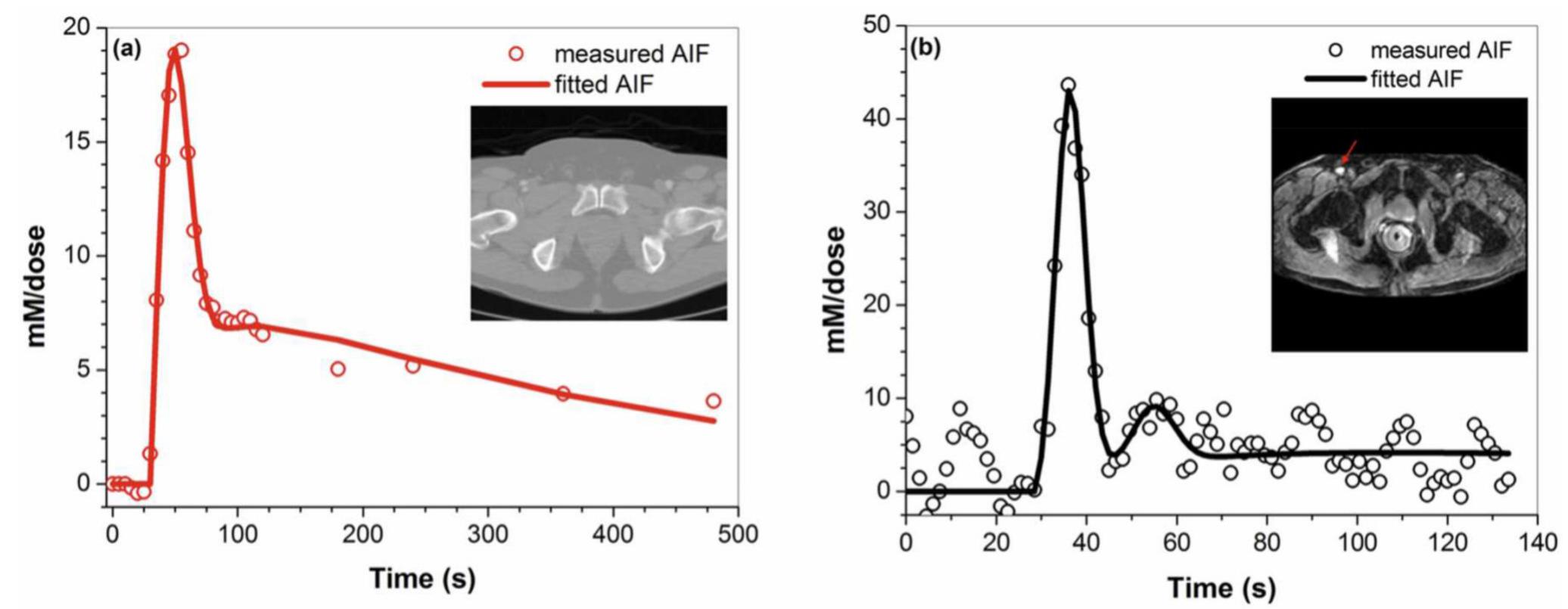 Figure 1 - Comparison of arterial input functions measured