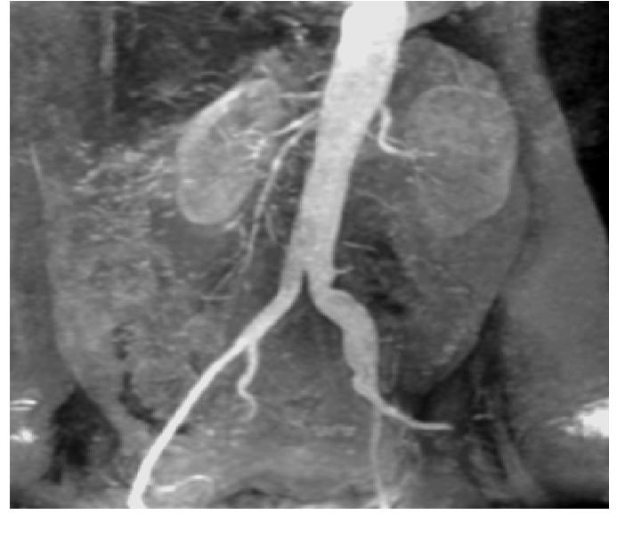 Images called angiograms of blood vessels. in this process,