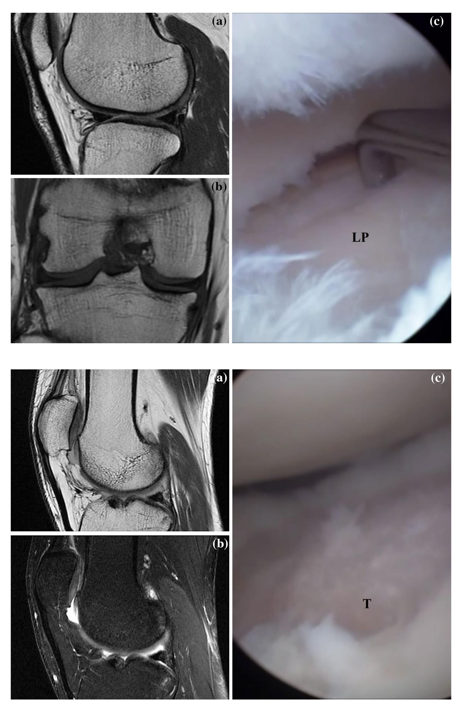 Important that these lesions be appropriately diagnosed and