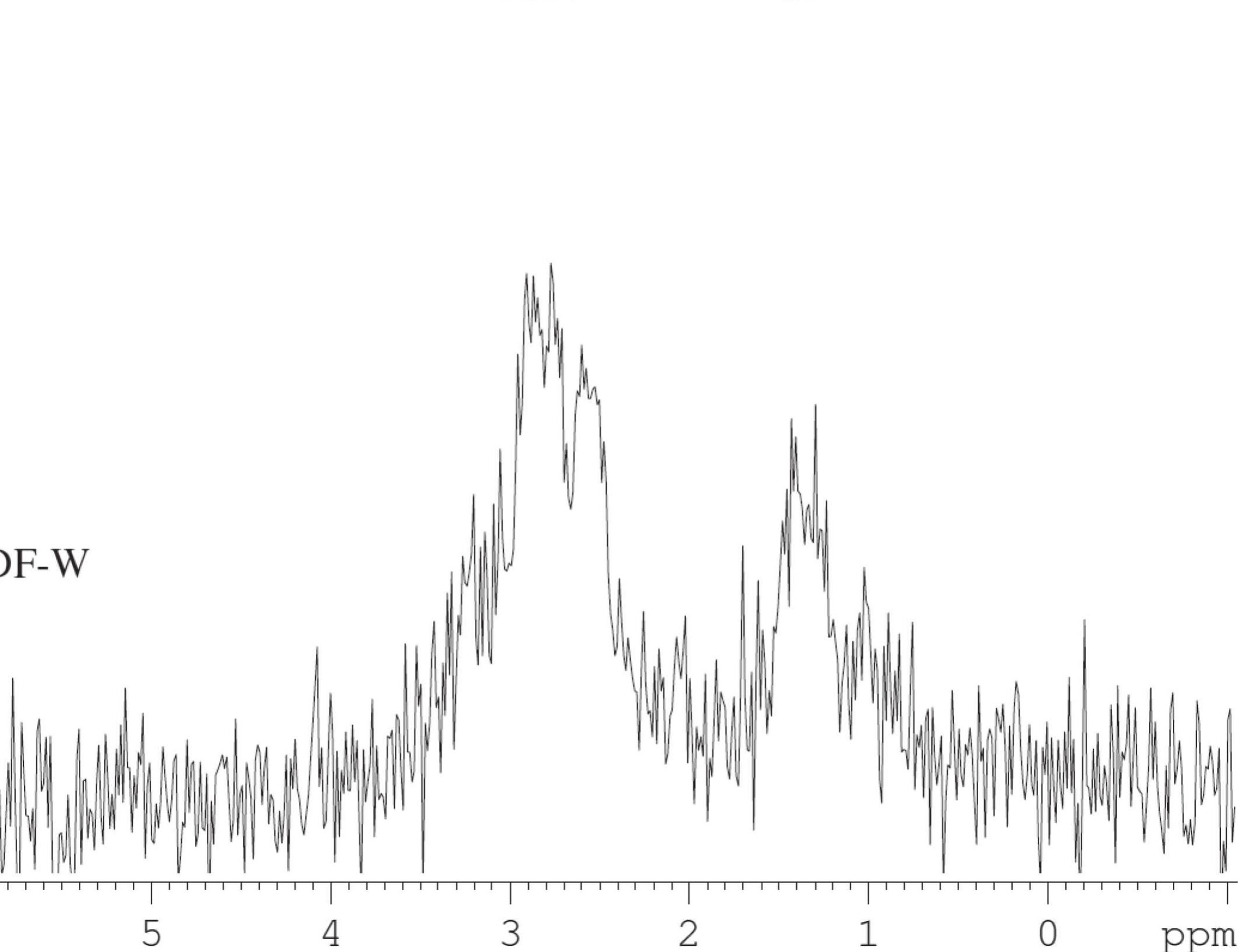 The *'p nuclear magnetic resonance (nmr) spectra of final