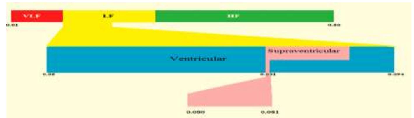 The mvf diagnosis diagram for ventricular and
