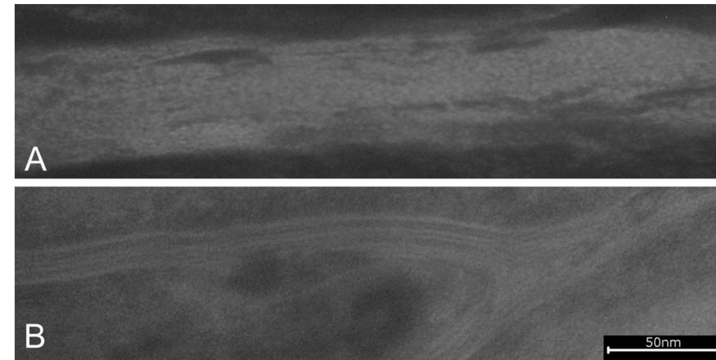 Selected tem images of untreated skin (a) and skin following