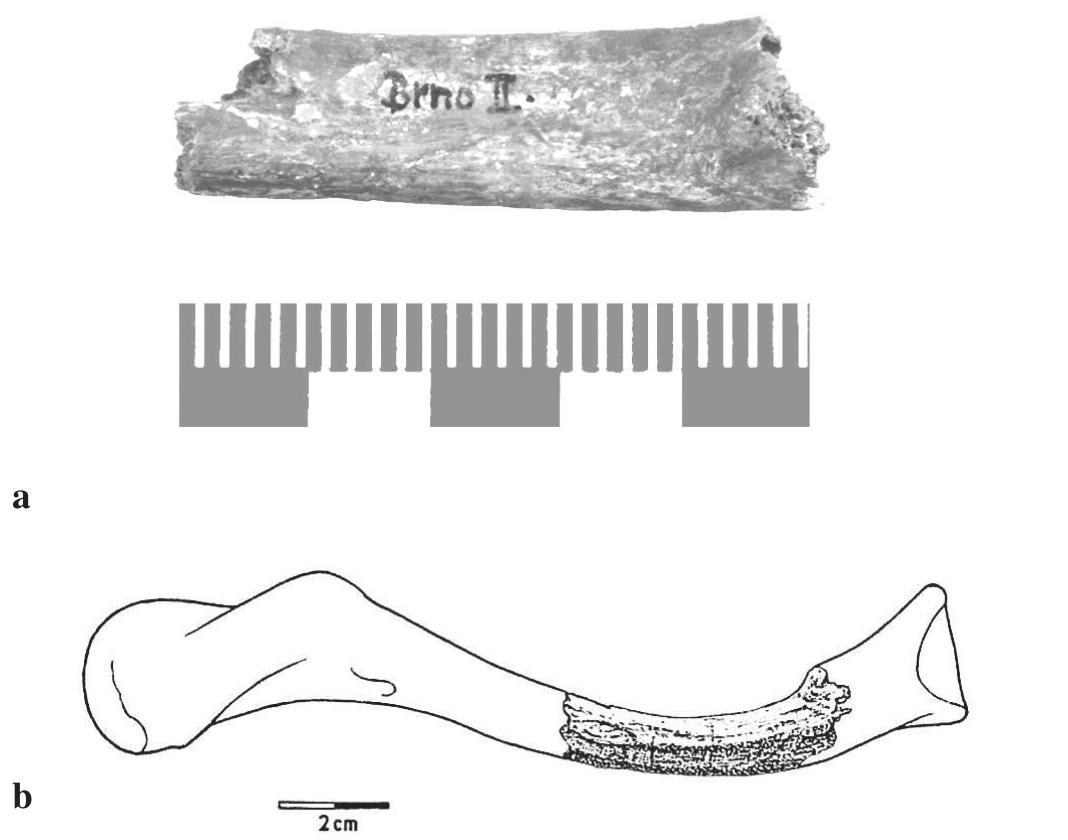 A — left clavicle — diaphysis, back view, b — anatomical
