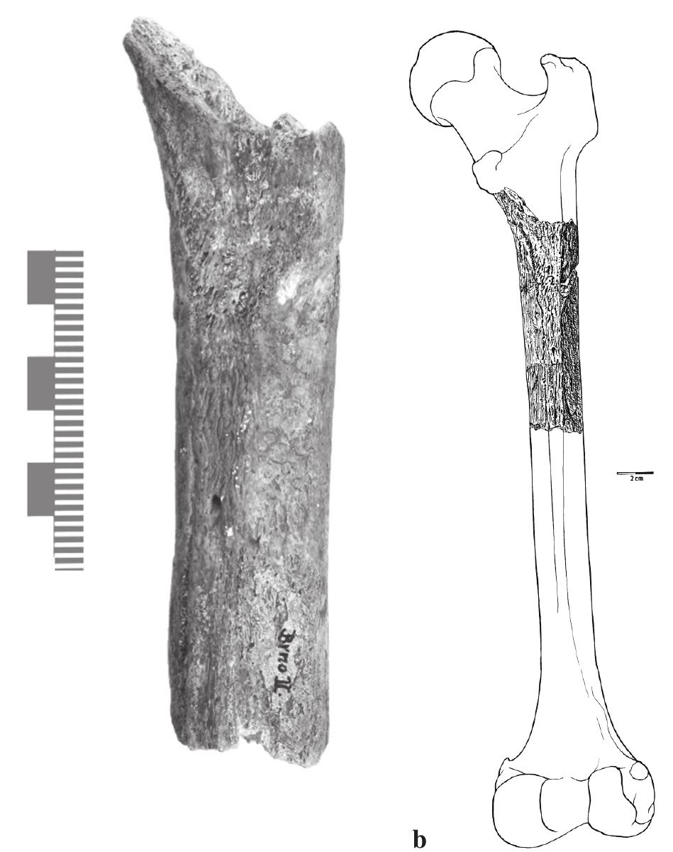 A-— right femur — proximal part, back view, b — anatomical