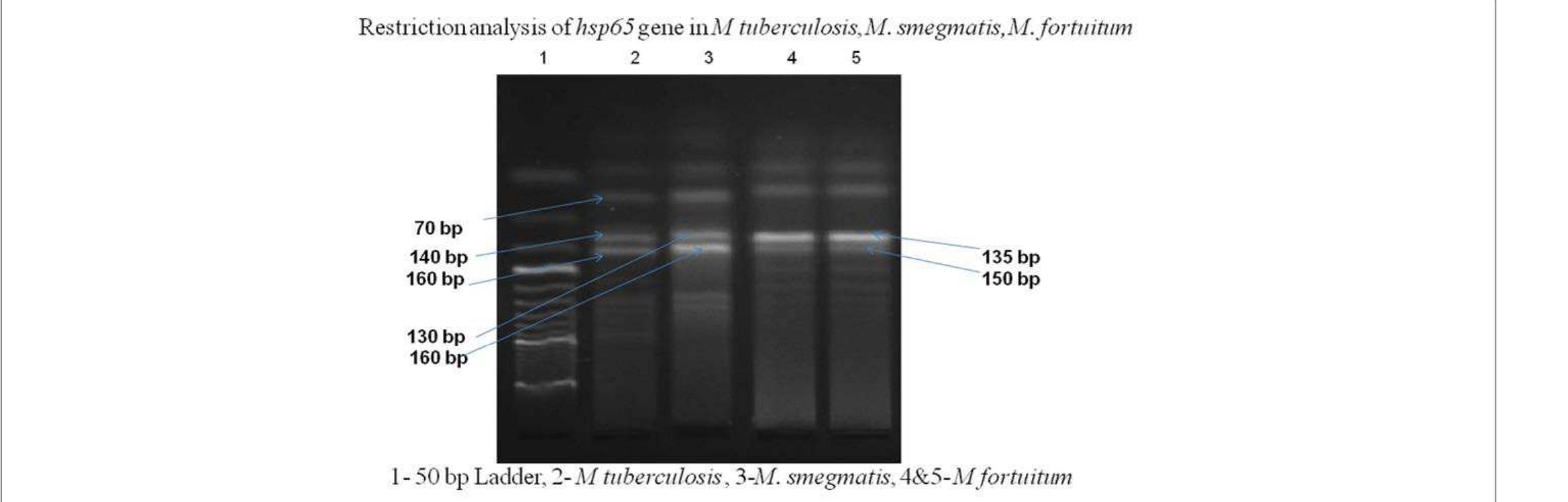 Identification of various mycobacterium by pcr-rflp