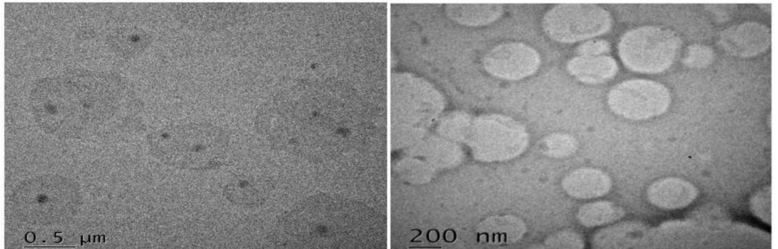 Morphology of eze-loaded nlc particles visualized by