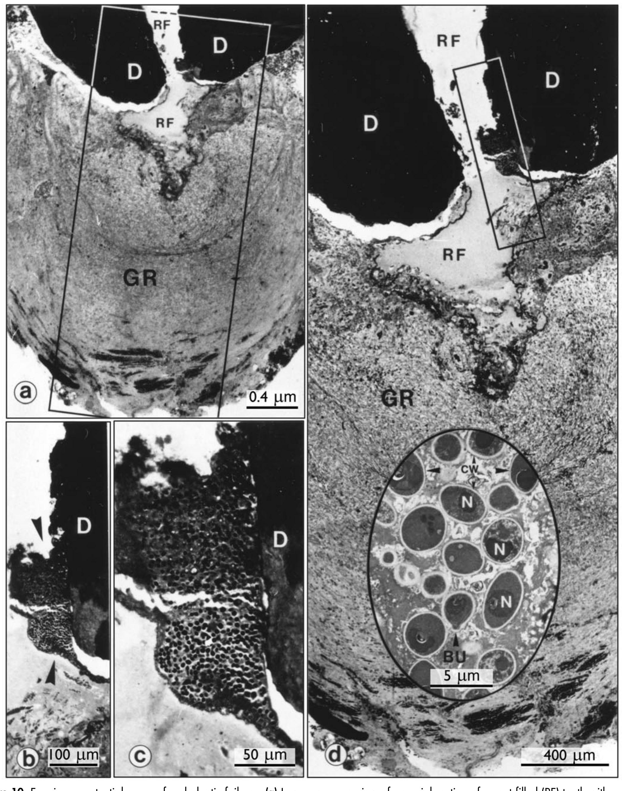 Figure 10 - Pathogenesis of apical periodontitis and the