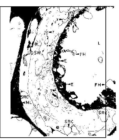 -6: heavy disintegration and complete collapse of cell walls