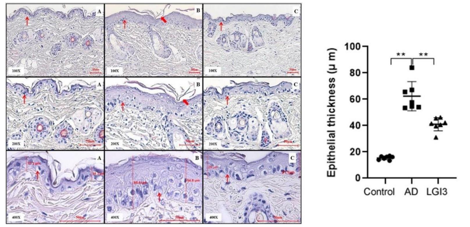 Thickness of epithelial cell layer of dorsal skin measured