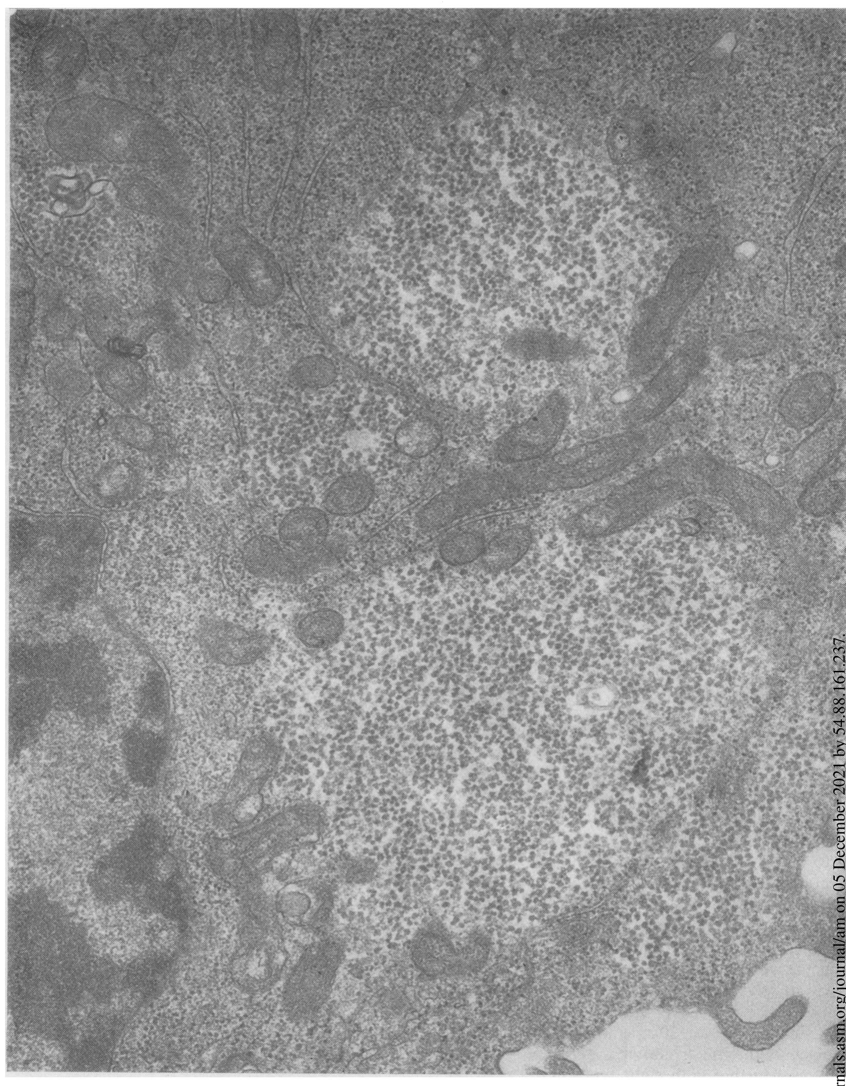 Figure 4 - Plaque formation by 55 rhinovirus serotypes