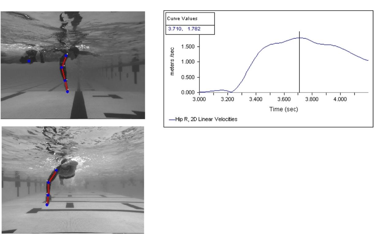Underneath the vertical line of the shoulder. figure 1 is a