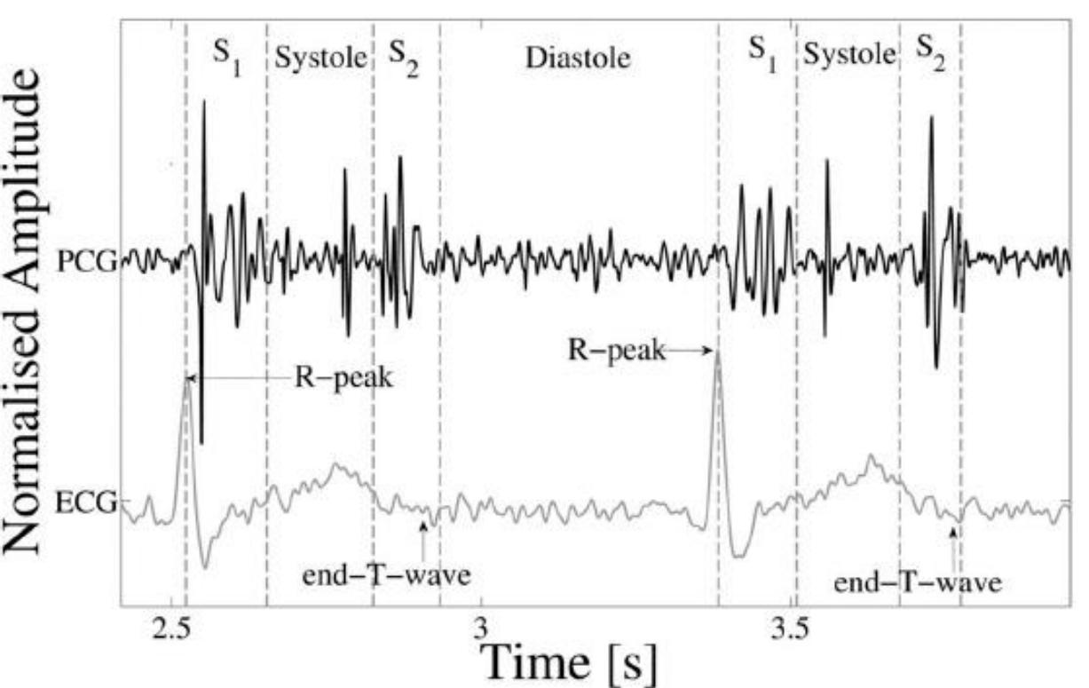 Example Of An Ecg Labelled Pcg With The Ecg Pcg And Four
