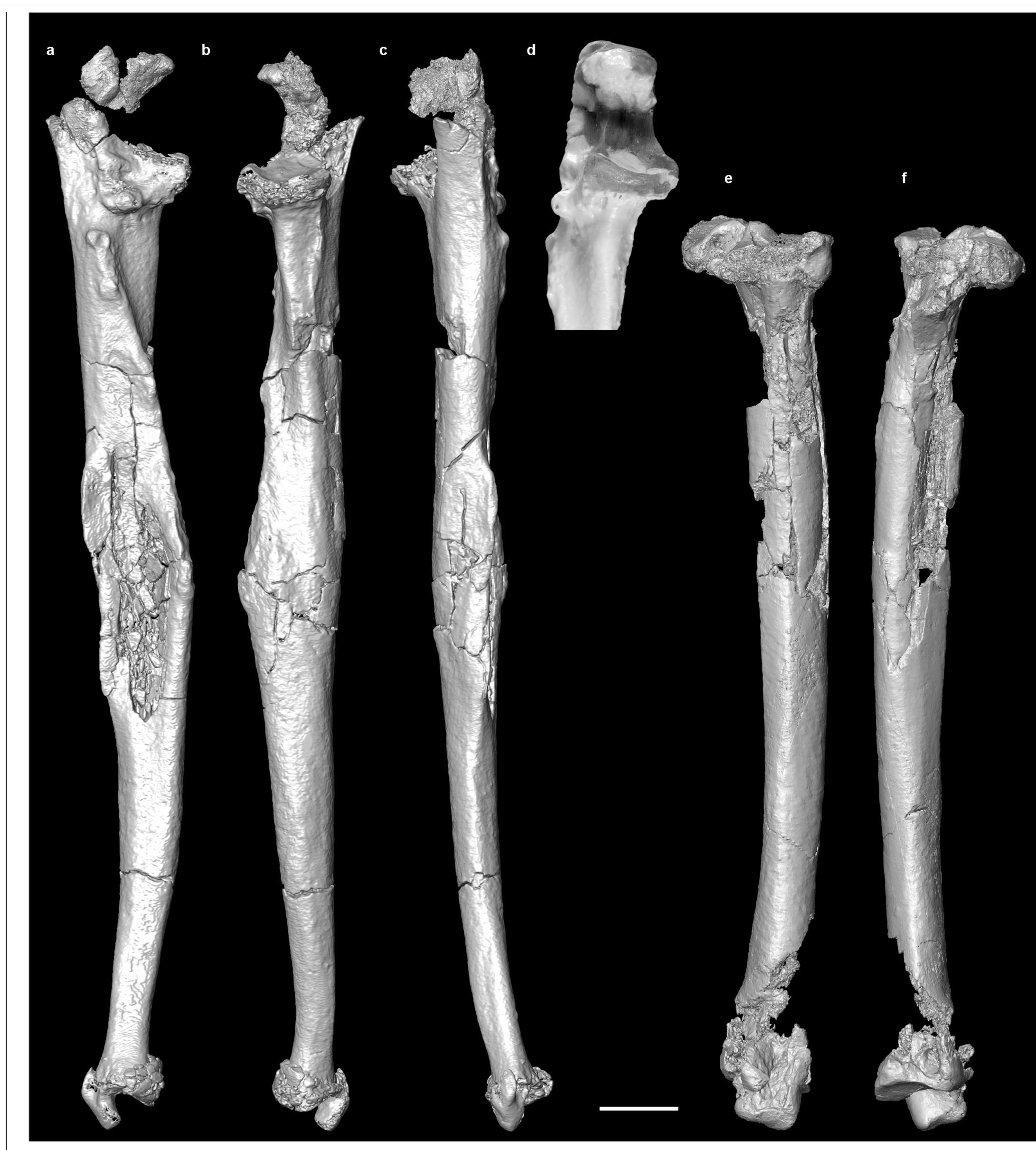 Olecranonin anterior view (d). e, f, medial (e) and lateral