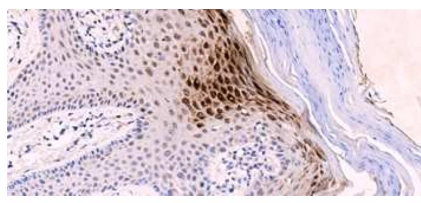 Normal squamous cervical epithelium exhibits a positive