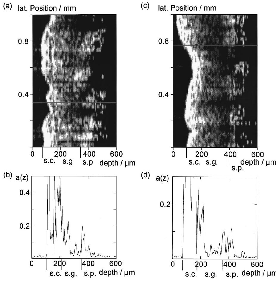 Optograms of the hand. (a) thickness of the layers, evalu-
