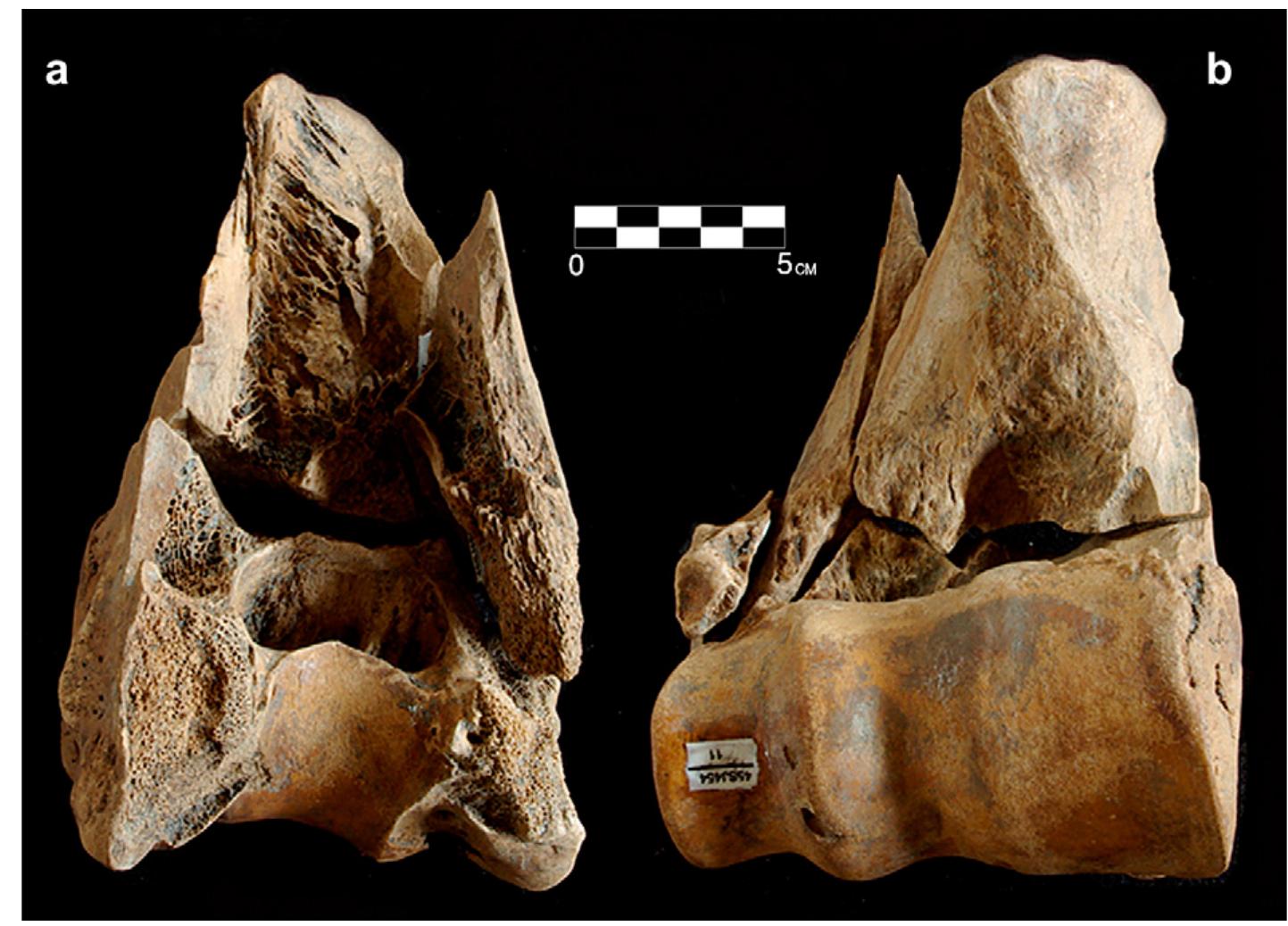 Posterior (a) and anterior (b) views of right distal humerus
