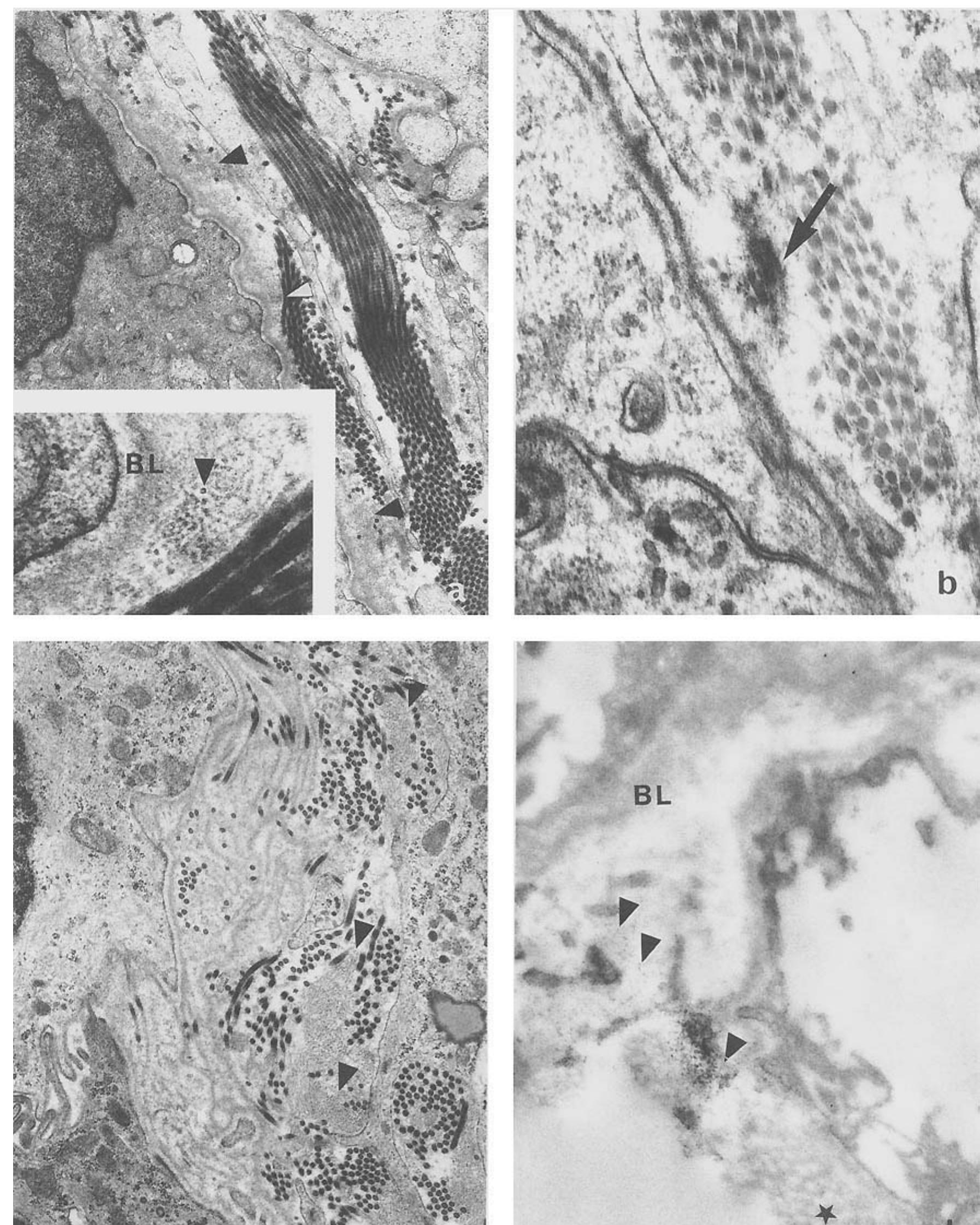 The ductular epithelium. x 37,500. c: basal lamina of the