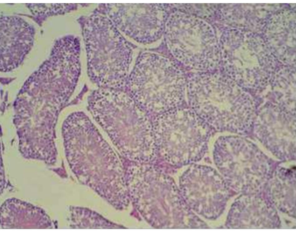Histological section of sl mice testis showing look-like