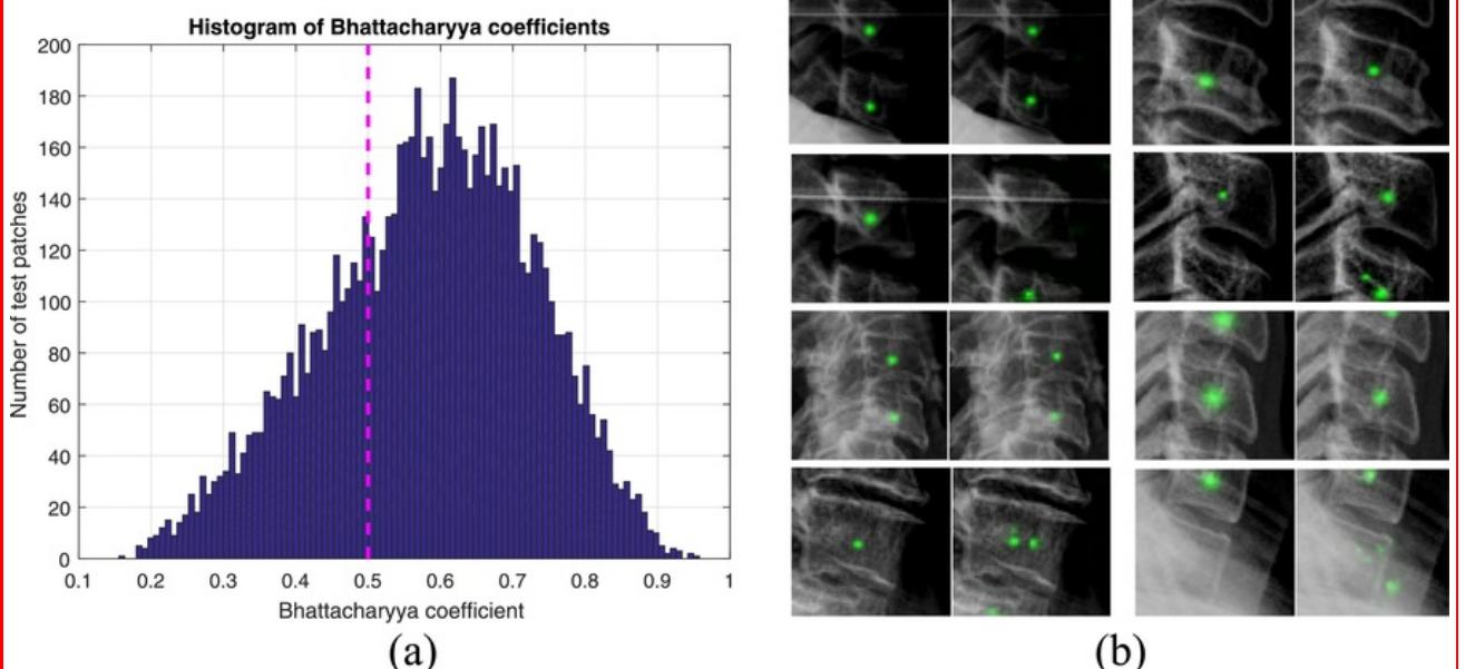 Figure 13 - Fully automatic cervical vertebrae segmentation