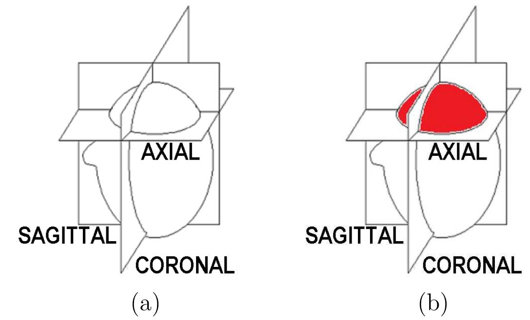 8: (a) delineation of a head shows the axial, sagittal and